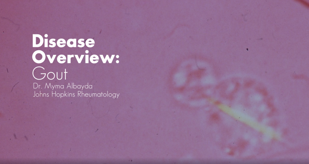 Gout: Basics, Symptoms and Treatment Options • Johns Hopkins Rheumatology
