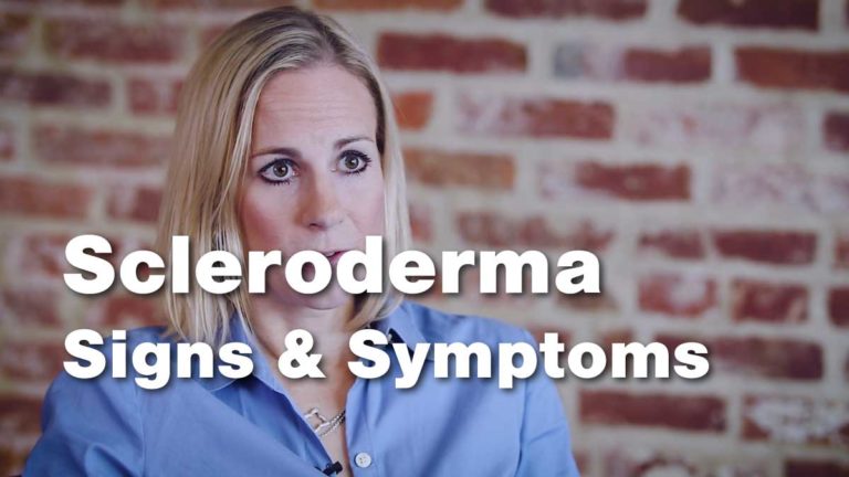 Signs and Symptoms of Scleroderma • Johns Hopkins Rheumatology